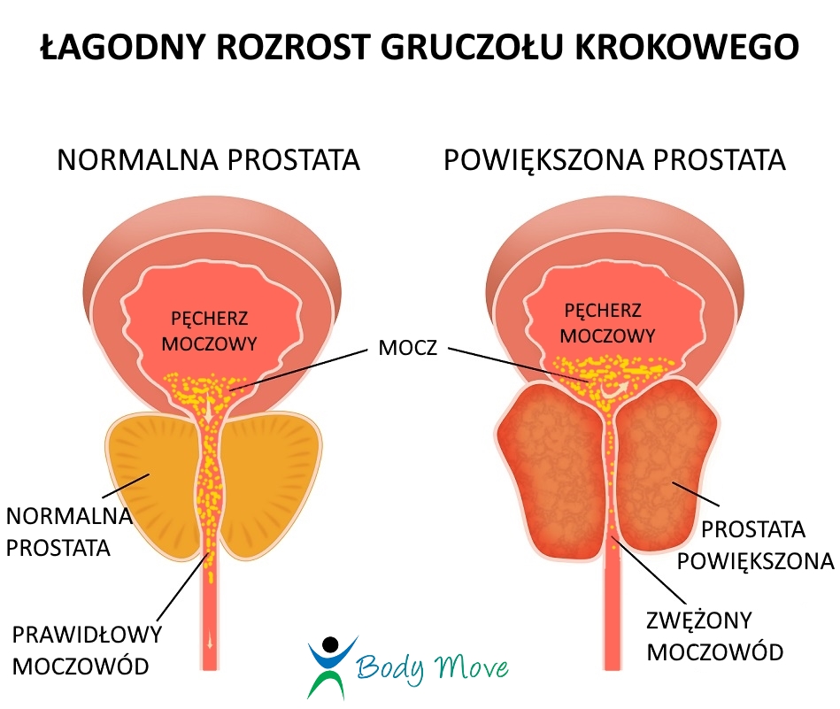 Badanie usg prostaty | Urolog Warszawa prywatnie